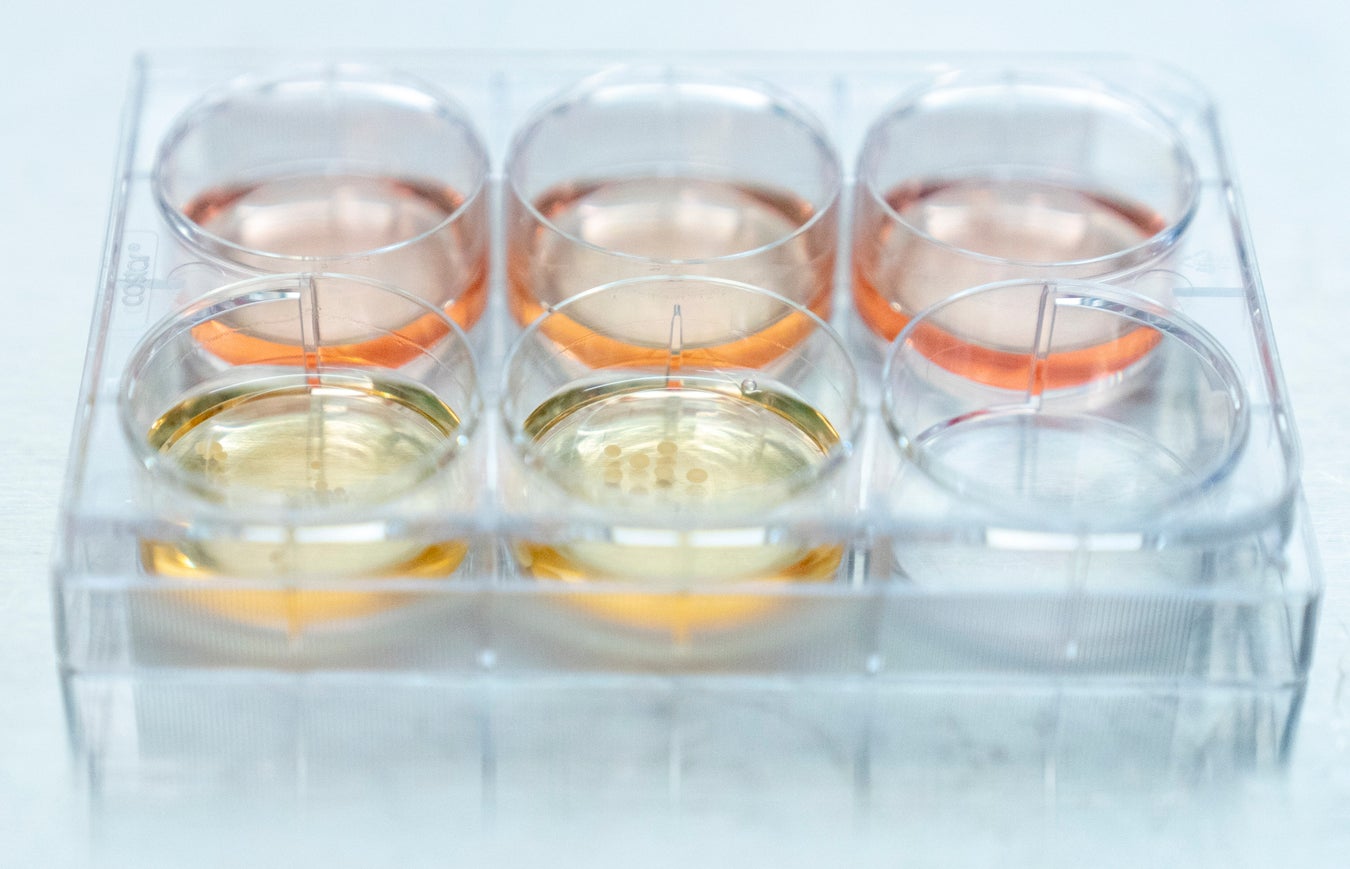 Lab-Grown "Mini Brains" Can Now Mimic the Neural Activity of a Preterm ...