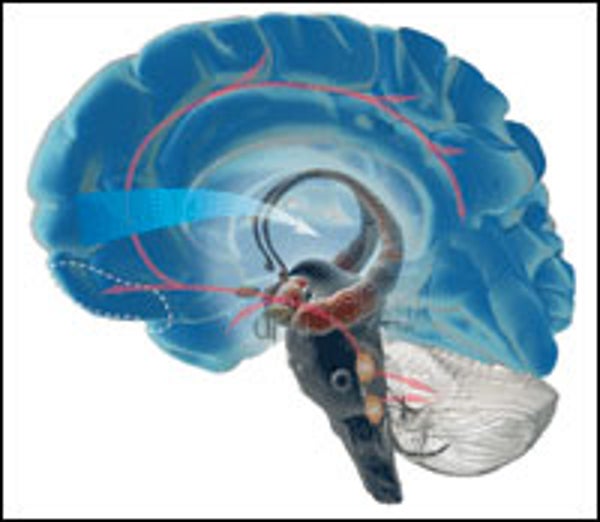 The Violent Brain | Scientific American