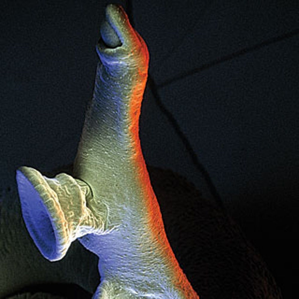 Fighting Killer Worms | Scientific American