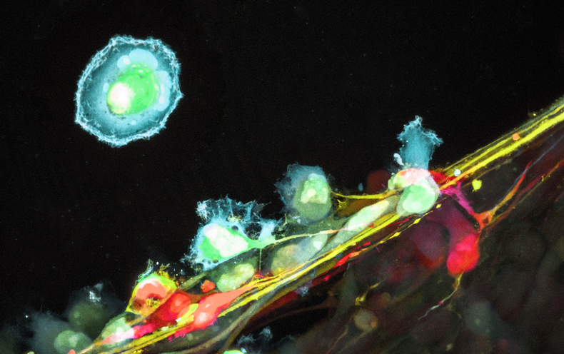 Prize-Winning Images of the Brain - Scientific American