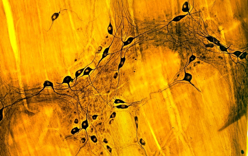 Think Twice: How the Gut's "Second Brain" Influences Mood and Well ...