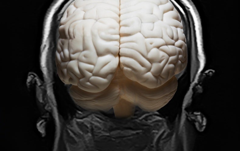 Huge Brain Study Uncovers "Buried" Genetic Networks Linked to Mental ...