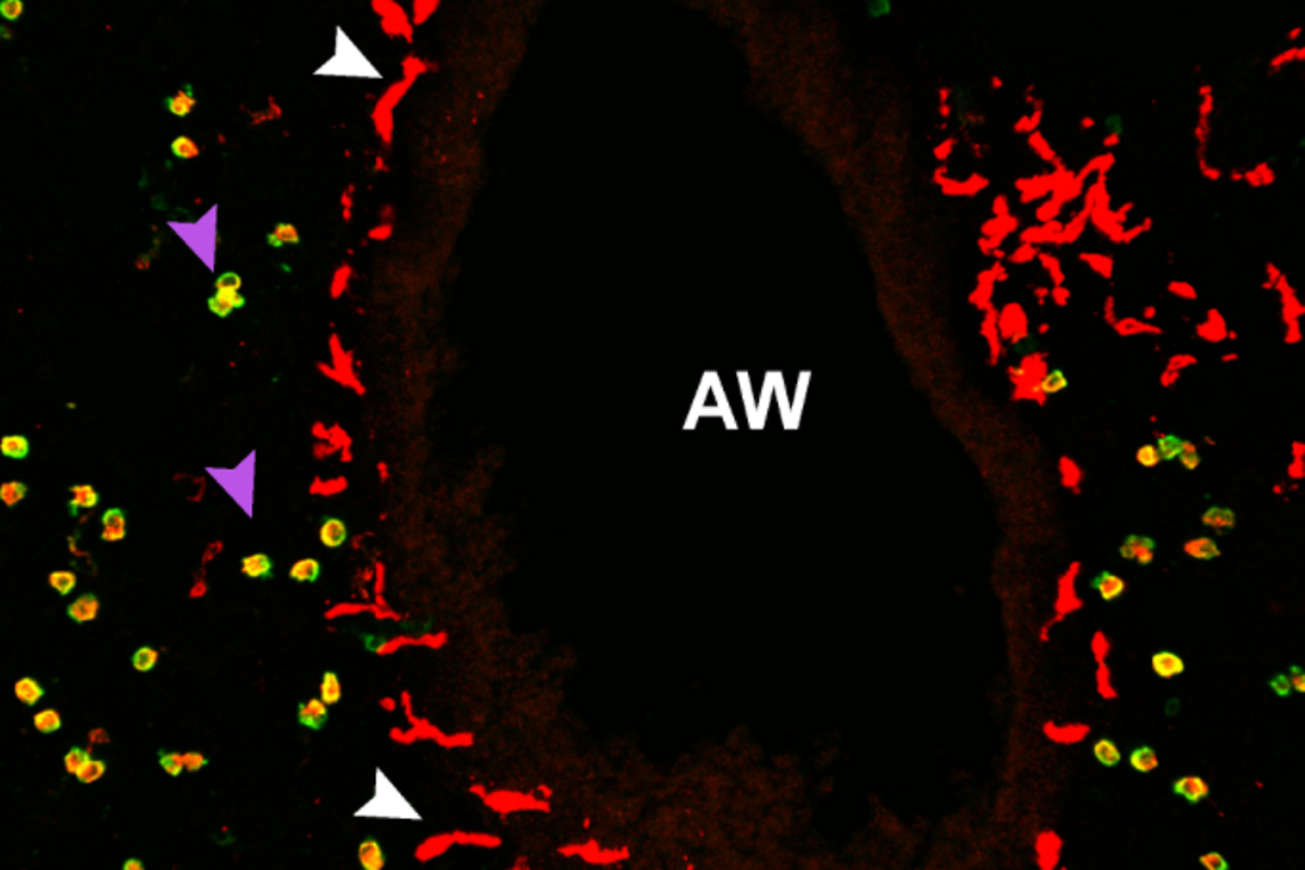 Could Newly Found "Peacekeeping" Cells Be a Weapon against COVID-19 ...