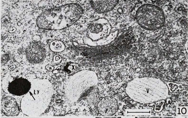 Medicine Nobel Recognizes "Self-Eating" Cell Research - Scientific American
