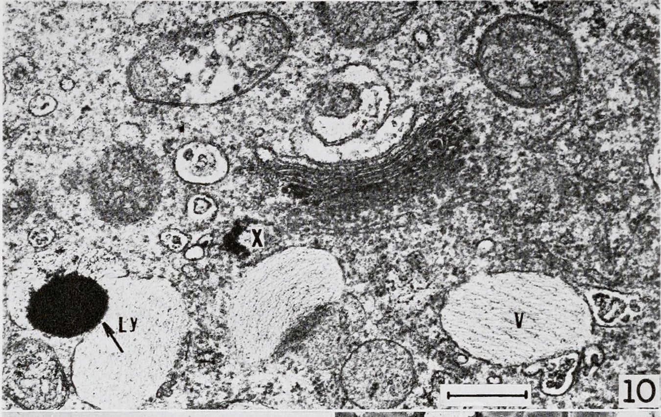 Medicine Nobel Recognizes "Self-Eating" Cell Research | Scientific American