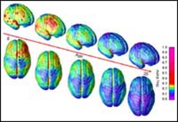 MRI Movie Maps Brain Development - Scientific American