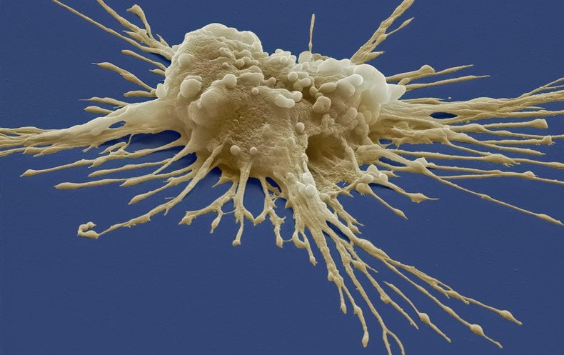 Lab-Grown Blood Stem Cells Produced at Last - Scientific American