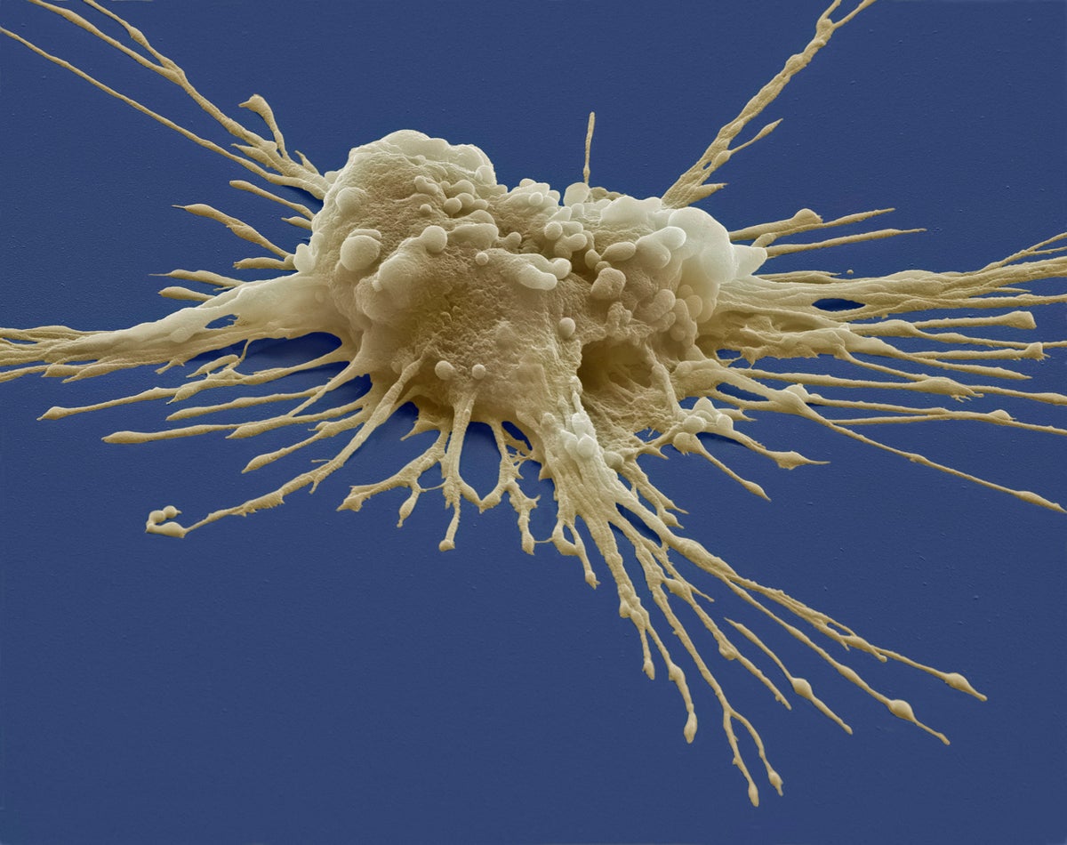 Lab-Grown Blood Stem Cells Produced at Last | Scientific American