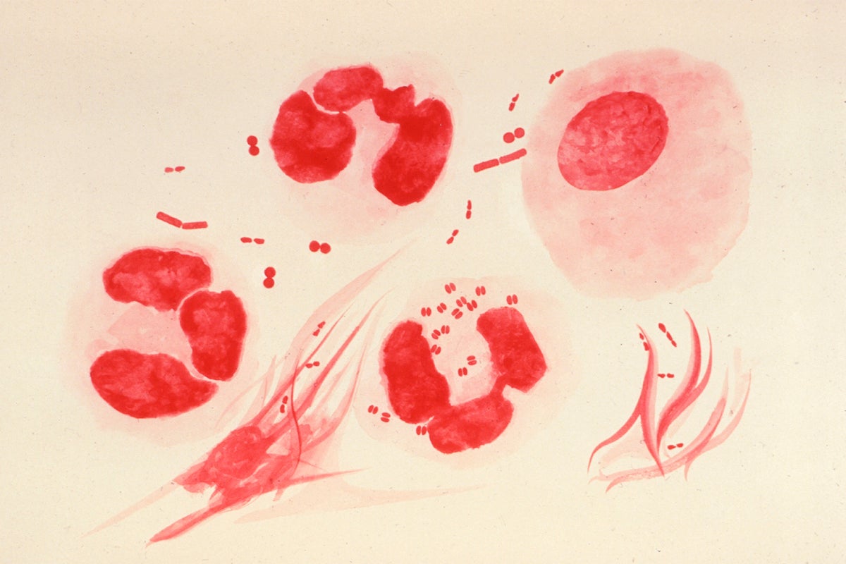 New At-Home STI Test Could Help Stop the Spread of Infection ...