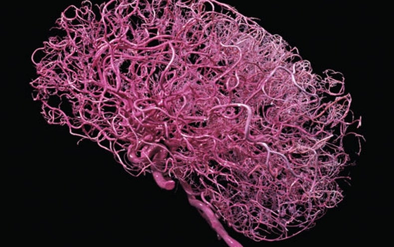 Brain Disorders Might Arise from Starving Neurons - Scientific American