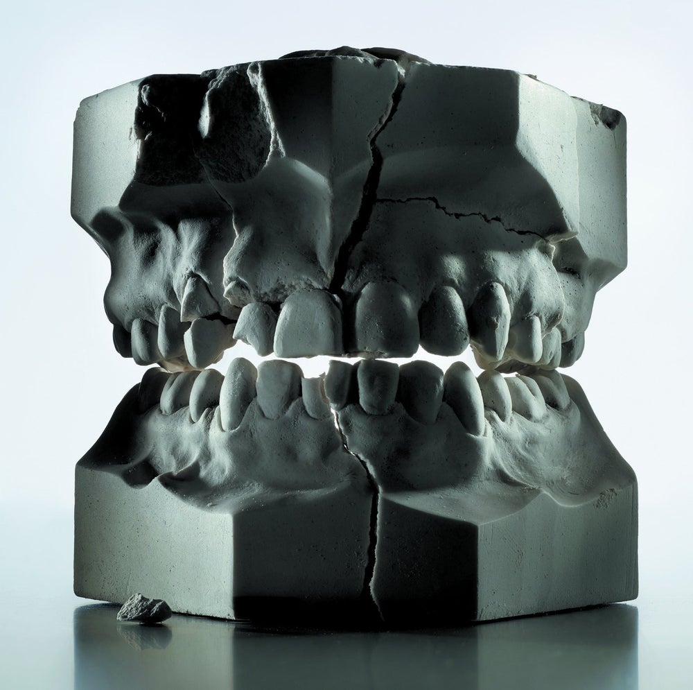 Why We Have So Many Problems with Our Teeth | Scientific American