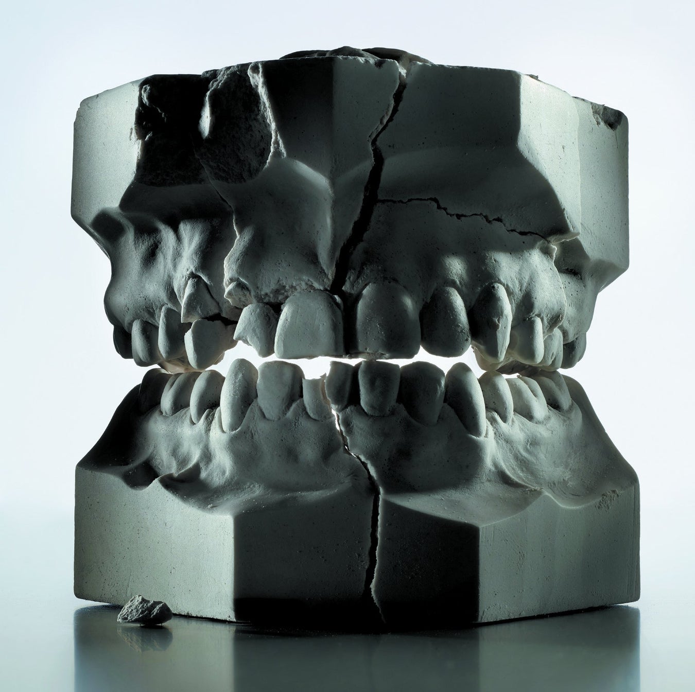 Why We Have So Many Problems with Our Teeth | Scientific American