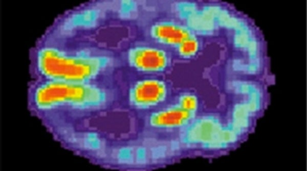 Do Brain Scans of Comatose Patients Reveal a Conscious State ... Do Brain Scans of Comatose Patients Reveal a Conscious State ...