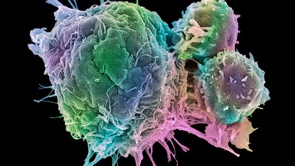 The Fight Against Cancer Is Increasingly Personal - Scientific American