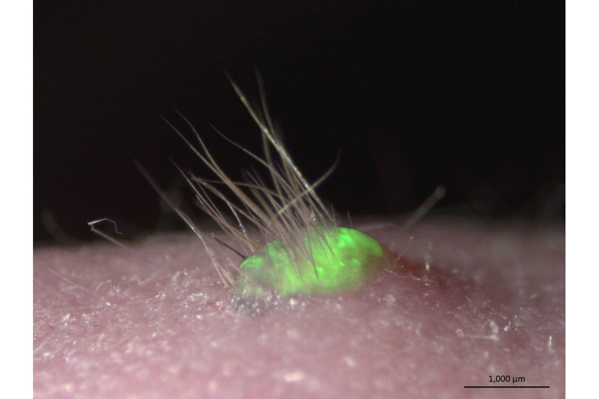 Lab-Grown Skin Sprouts Hair and Sweats | Scientific American