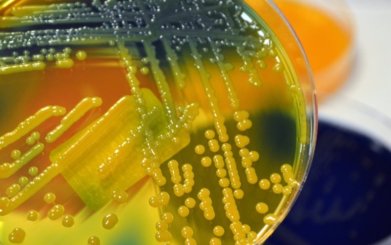 "Nightmare Bacteria" Widespread in U.S. Hospitals - Scientific American