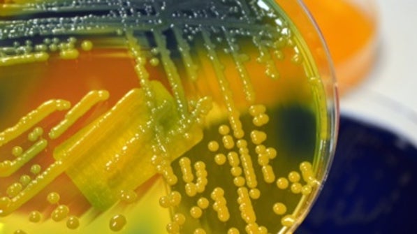 "Nightmare Bacteria" Widespread in U.S. Hospitals - Scientific American