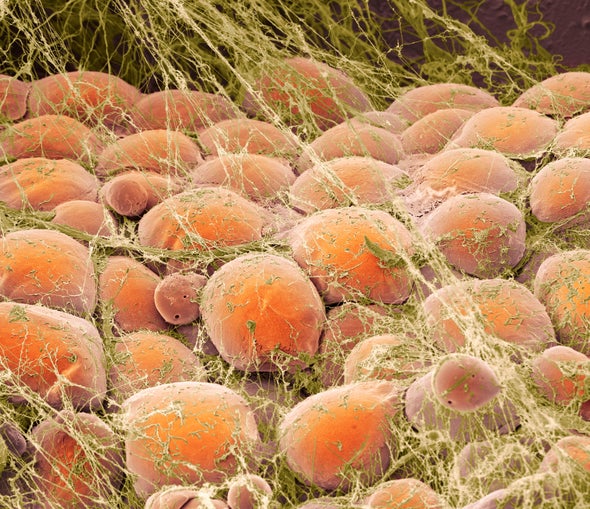 Fat Fuels Cancer's Spread in Mice - Scientific American