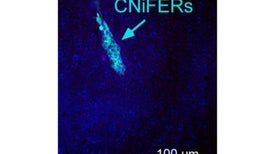 Stories by Sara Chodosh News and Research - Scientific American