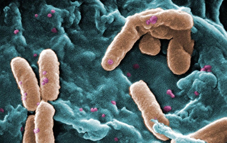 WHO Releases List of World's Most Dangerous Superbugs - Scientific American