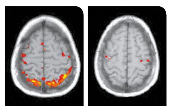 So, You Want to Be a Synesthete? - Scientific American