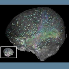 Mapping the Mind: Online Interactive Atlas Shows Activity of 20,000 ...
