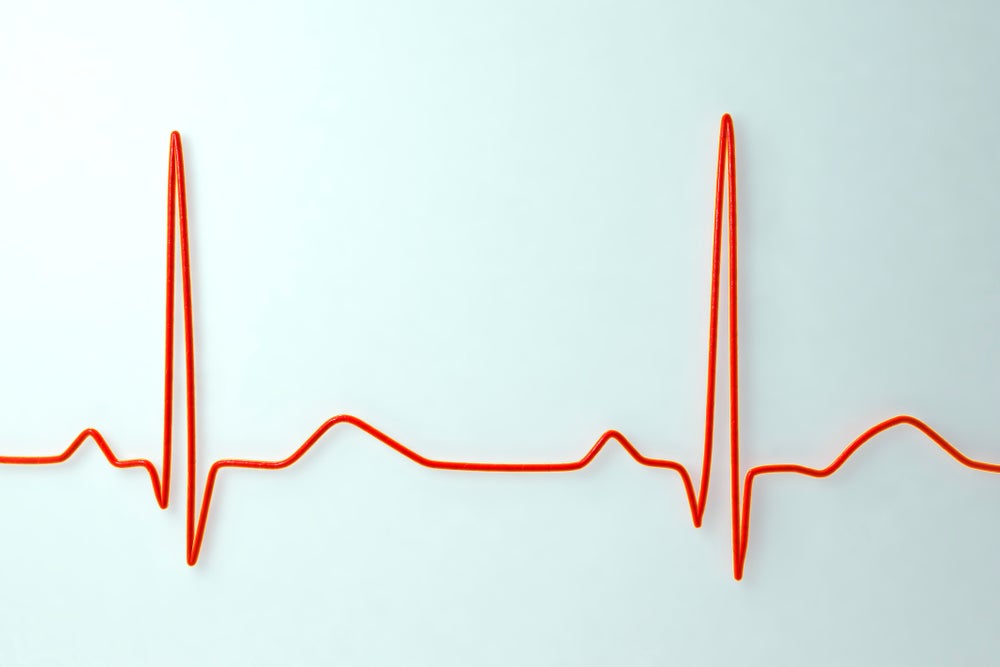 Heart Rate Variability (HRV): What It Is and How to Improve It ...