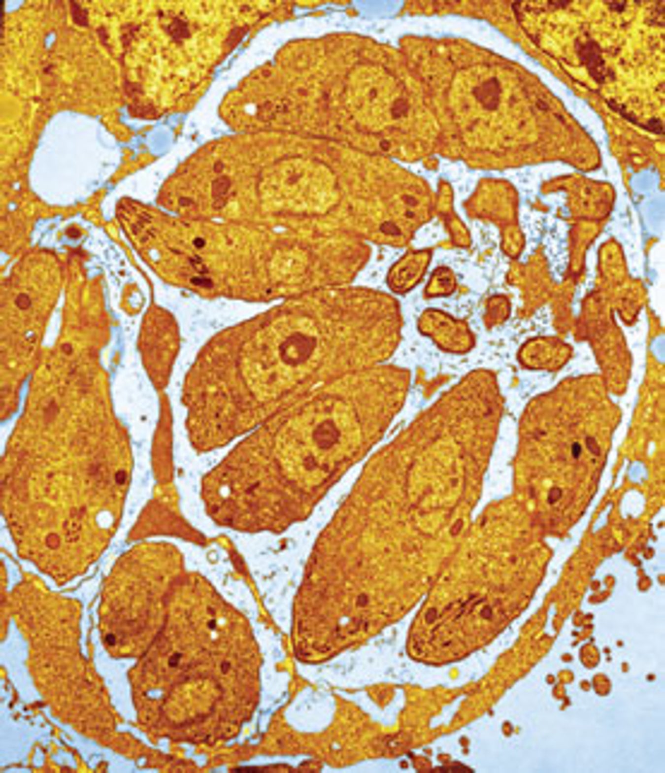 Common Parasite Linked to Personality Changes | Scientific American