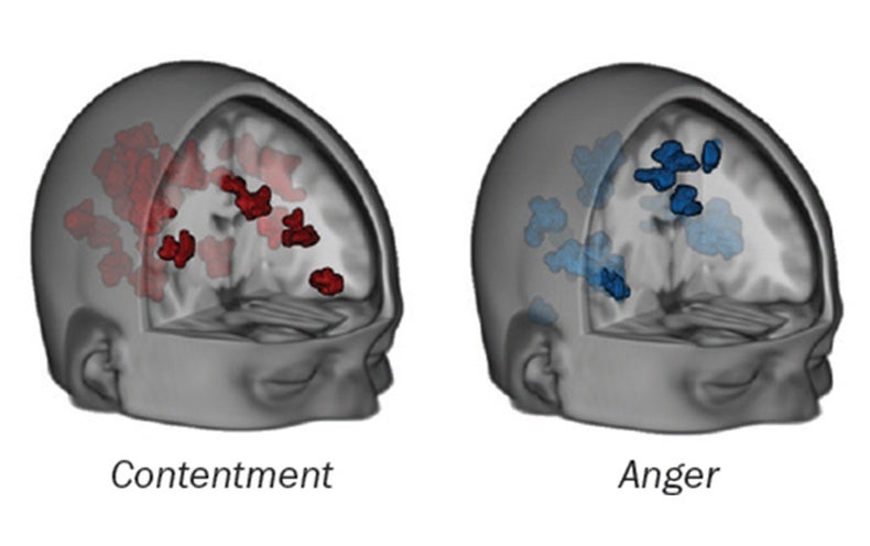 Can You Tell Someone's Emotional State from an MRI? - Scientific American