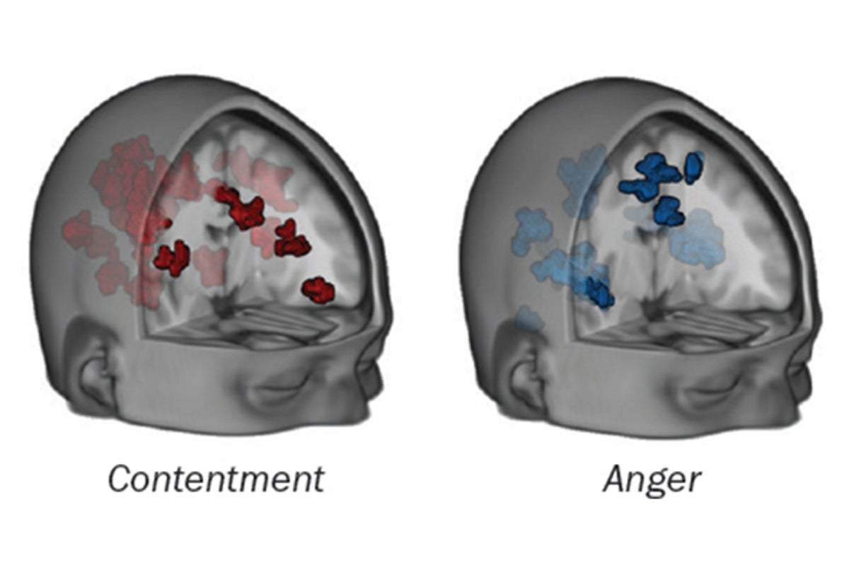 Can You Tell Someone's Emotional State from an MRI? | Scientific American