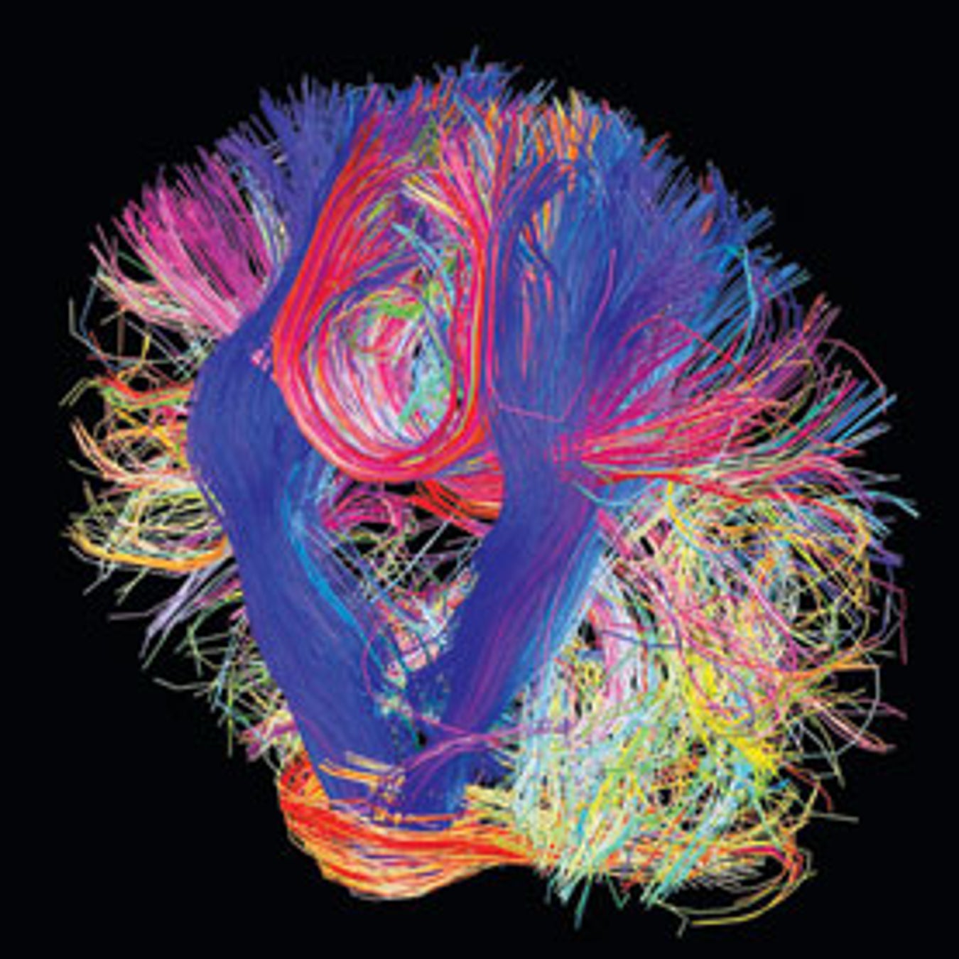 A Countdown to a Digital Simulation of Every Last Neuron in the Human ...