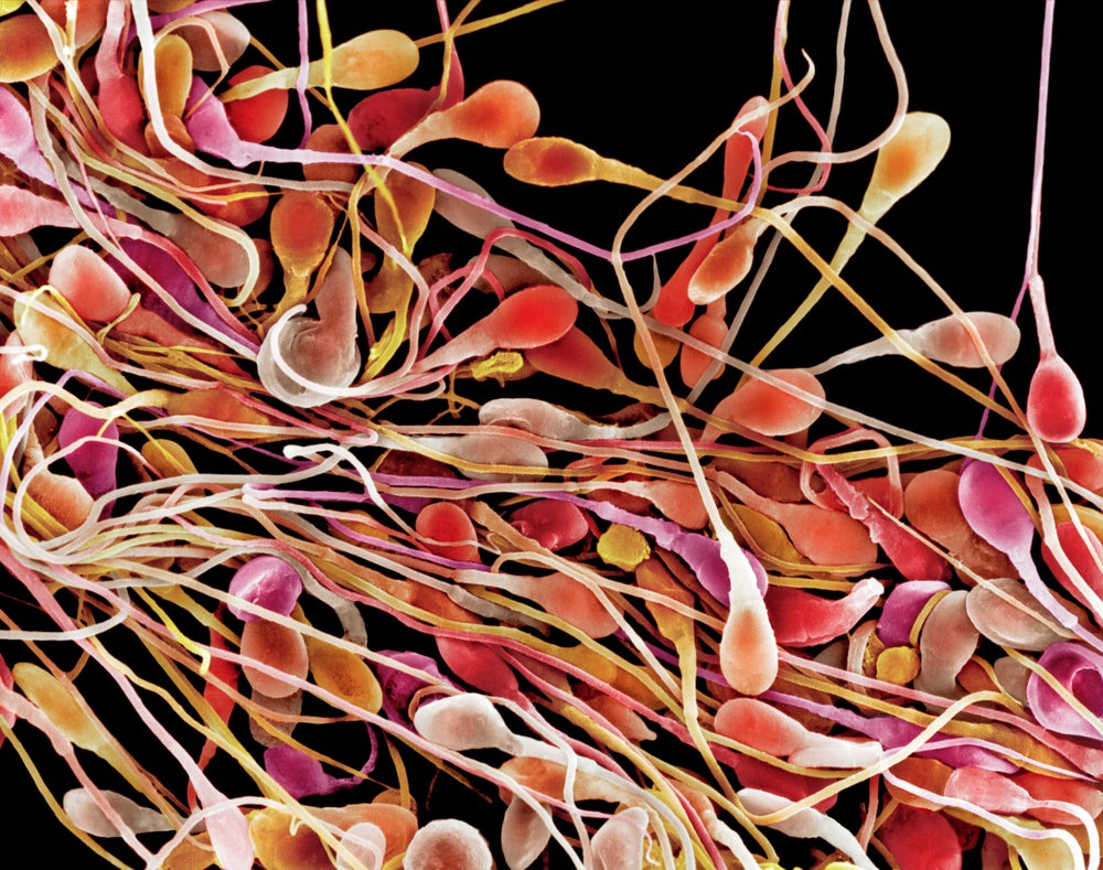 Are Sperm Counts Really Declining? | Scientific American