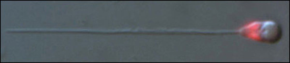 Mitochondria Mystery Solved | Scientific American