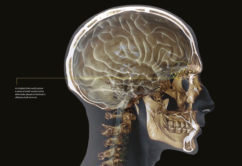 Building a Brain Implant for Smell | Scientific American