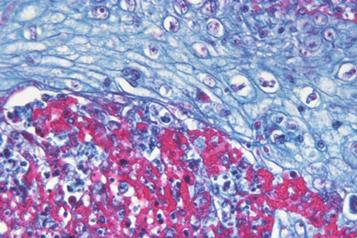 Scientists Re-created an Extinct Virus | Scientific American