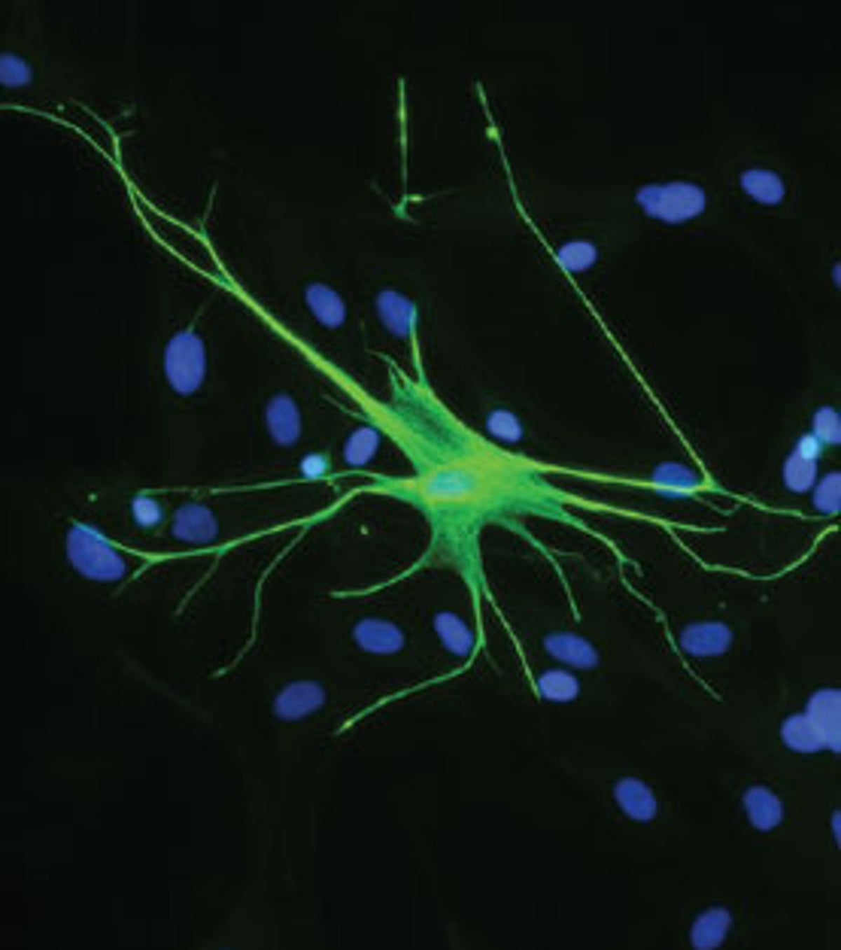 Marijuana Reveals Memory Mechanism | Scientific American