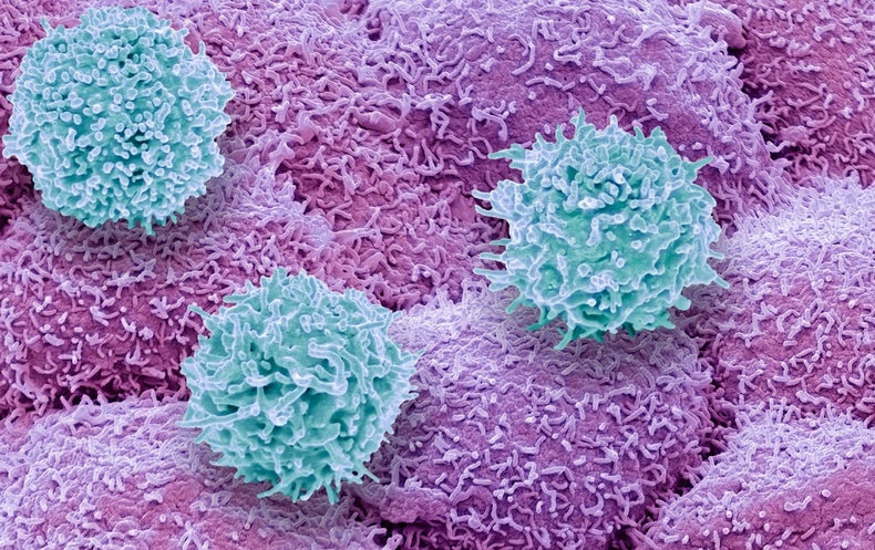 Retooling T Cell Therapies to Target Solid Tumors - Scientific American