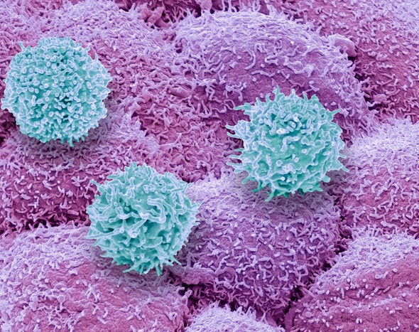 Retooling T Cell Therapies to Target Solid Tumors - Scientific American