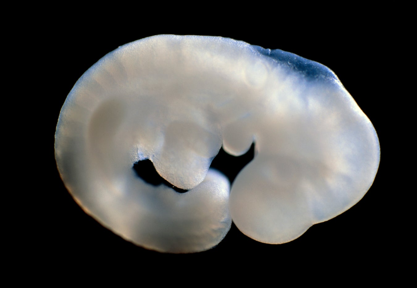 Japan Approves First Human-Animal Embryo Experiments | Scientific American
