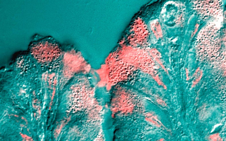 Mucus: The Body's Unsung Hero - Scientific American