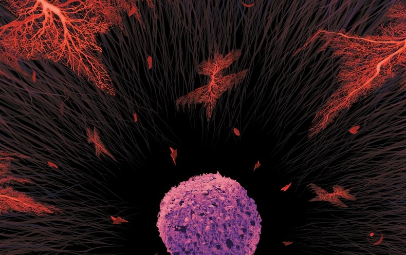 A Shot against Cancer - Scientific American