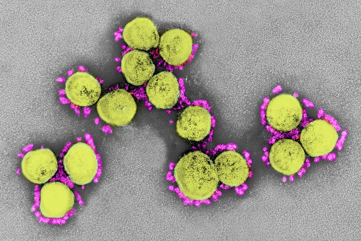 Neandertal DNA May Be COVID Risk | Scientific American