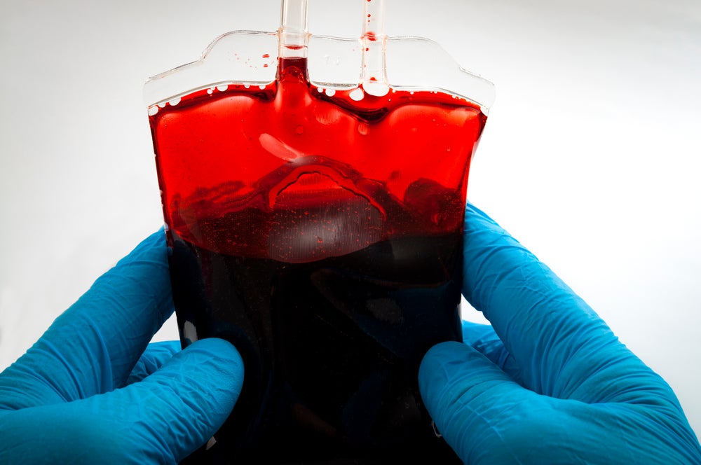 Blood Boundaries: Should Transfusions Be Matched by Sex? | Scientific ...