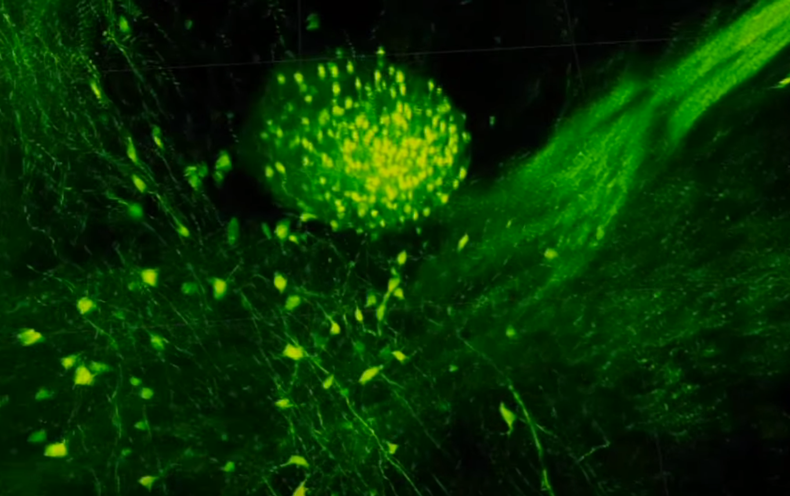 Scientists Create a Window into the Brain [Video] - Scientific American
