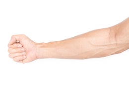 Strain In Forearm Clearance Sale Save 52 Jlcatj gob mx