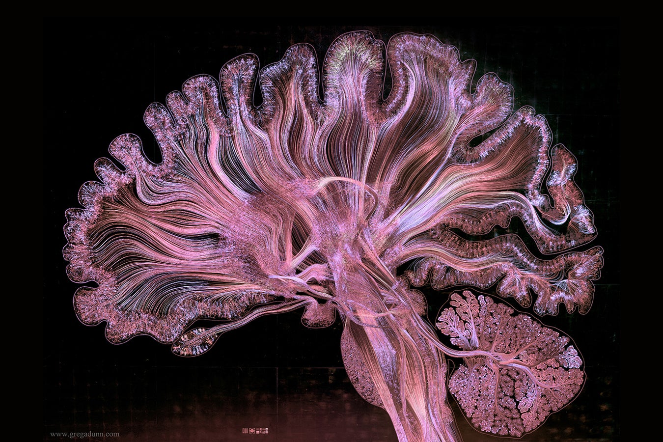 Watch the Human Brain Come to Life in This Stunning Piece of Art ...