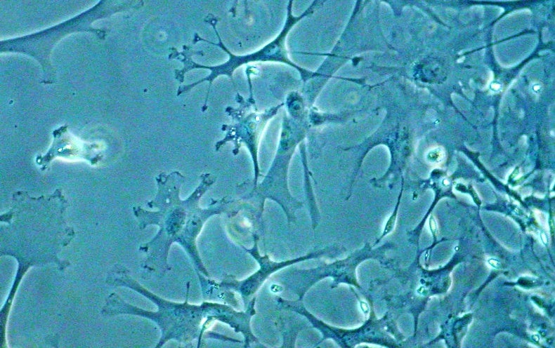 Cell Therapy 2.0: Reprogramming the Brain's Own Cells for Parkinson's ...