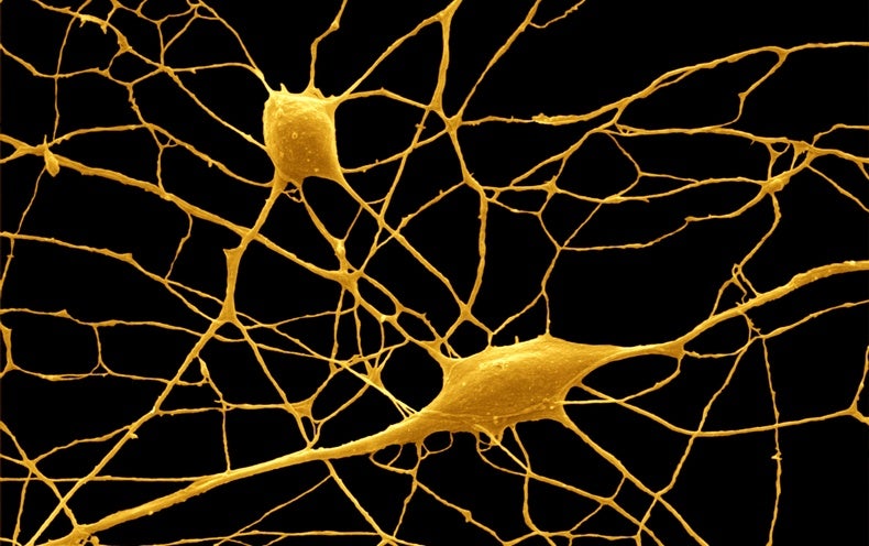 Is "Junk DNA" What Makes Humans Unique? - Scientific American