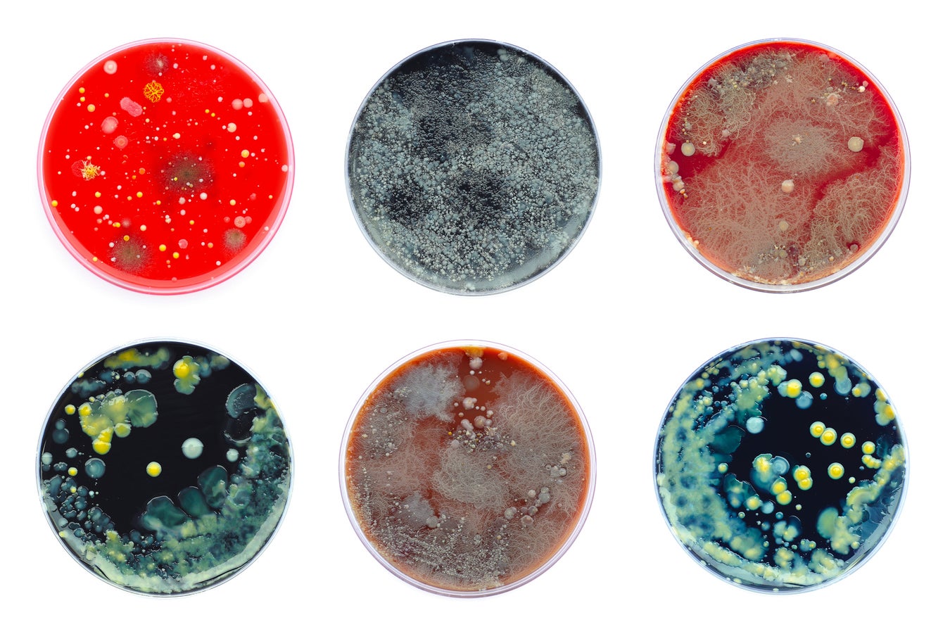 Culture Shock: Precious Microbe Collections Languish in Threatened Bio ...