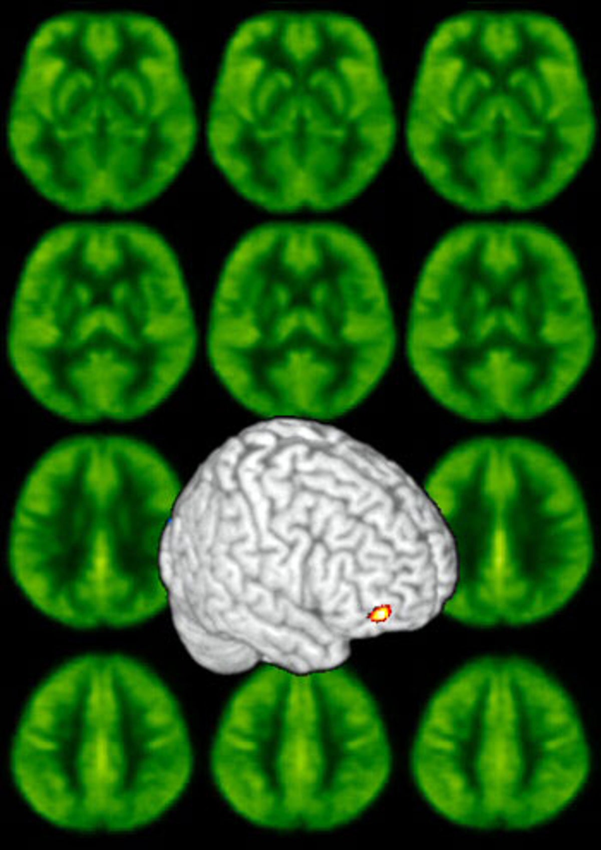 Stress on the Brain | Scientific American